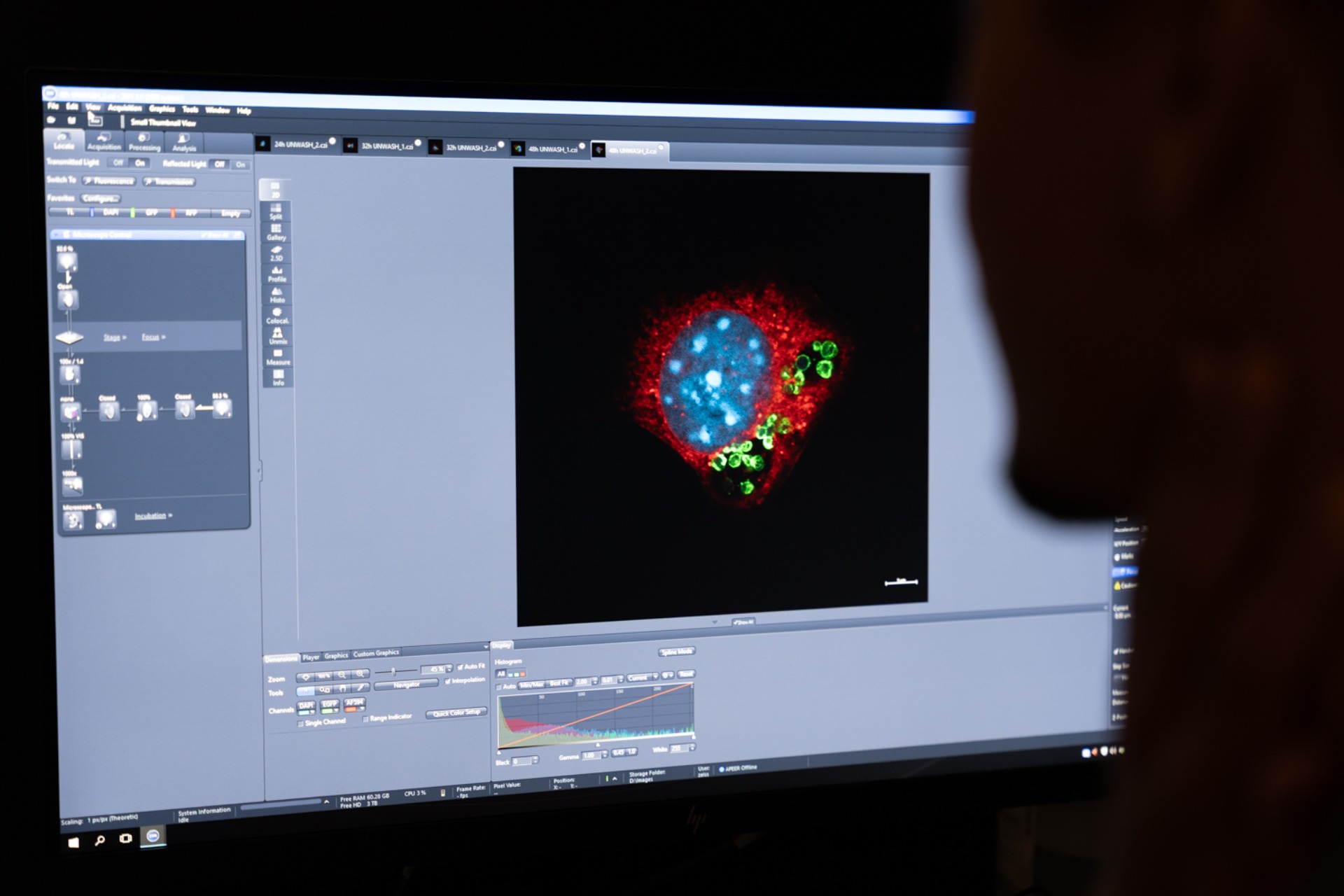 Daniel Rodriguez Rozo primé au congrès annuel de la SSM | CHUV